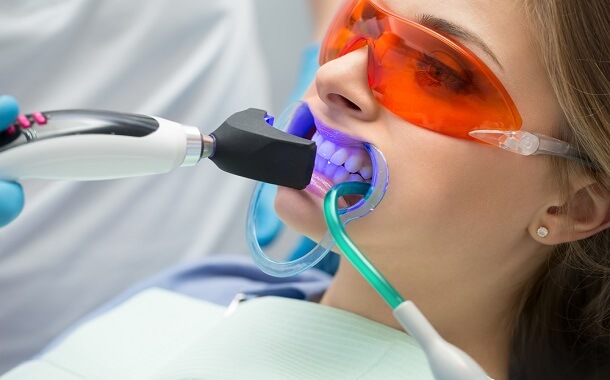 How Much Does Zoom Whitening Cost?