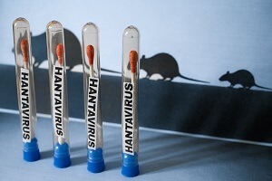 How Much Does Hantavirus Testing Cost?